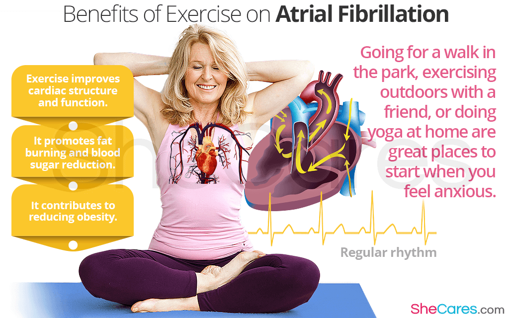 Atrial Fibrillation And Exercise Important Things To Know Shecares